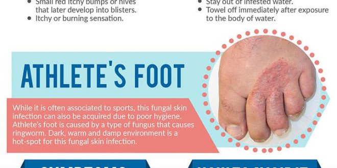 How to Avoid Summer Rashes and other Skin Problems | Infographic Portal