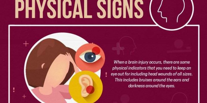 Warning Signs of Serious Brain Injuries | Infographic Portal